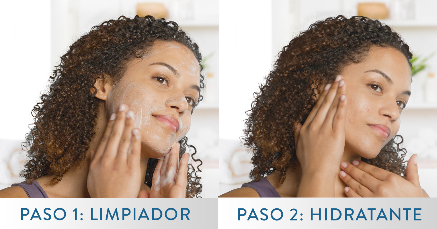 Cómo tener la piel clara: consejos para tratar la piel propensa al acné